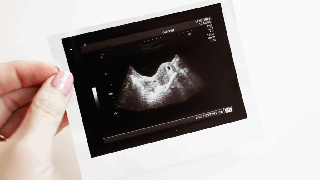 Understanding Pregnancy Ultrasounds: What It Is, How It Works, and Why ...
